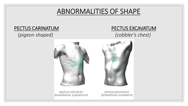 Respiratory examination insp+palp | PPTX