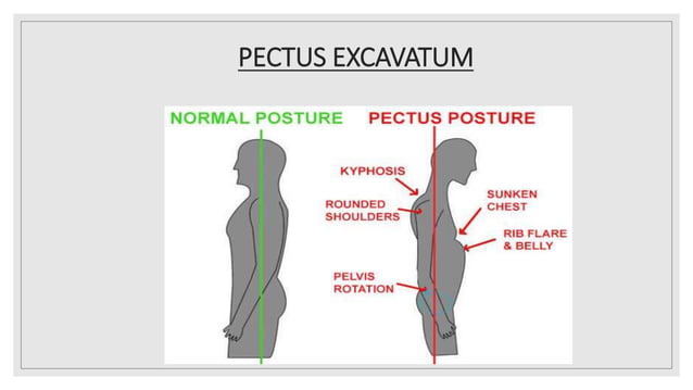Respiratory examination insp+palp | PPTX