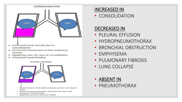 Respiratory examination insp+palp | PPTX