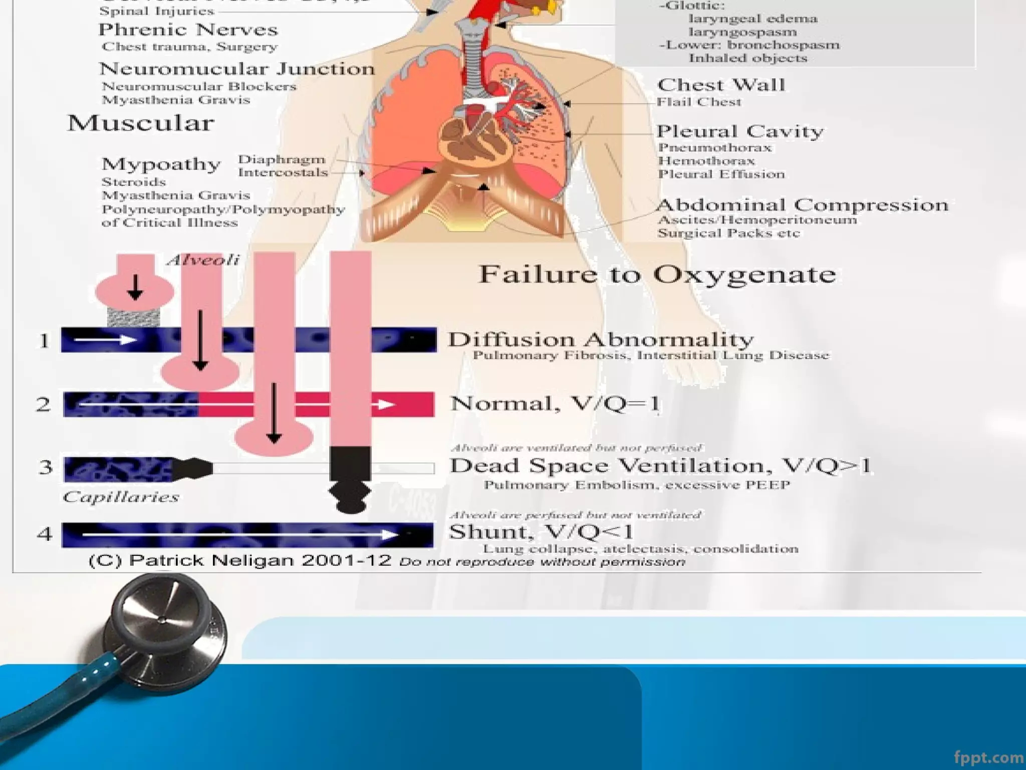 Respiratory failure | PPT