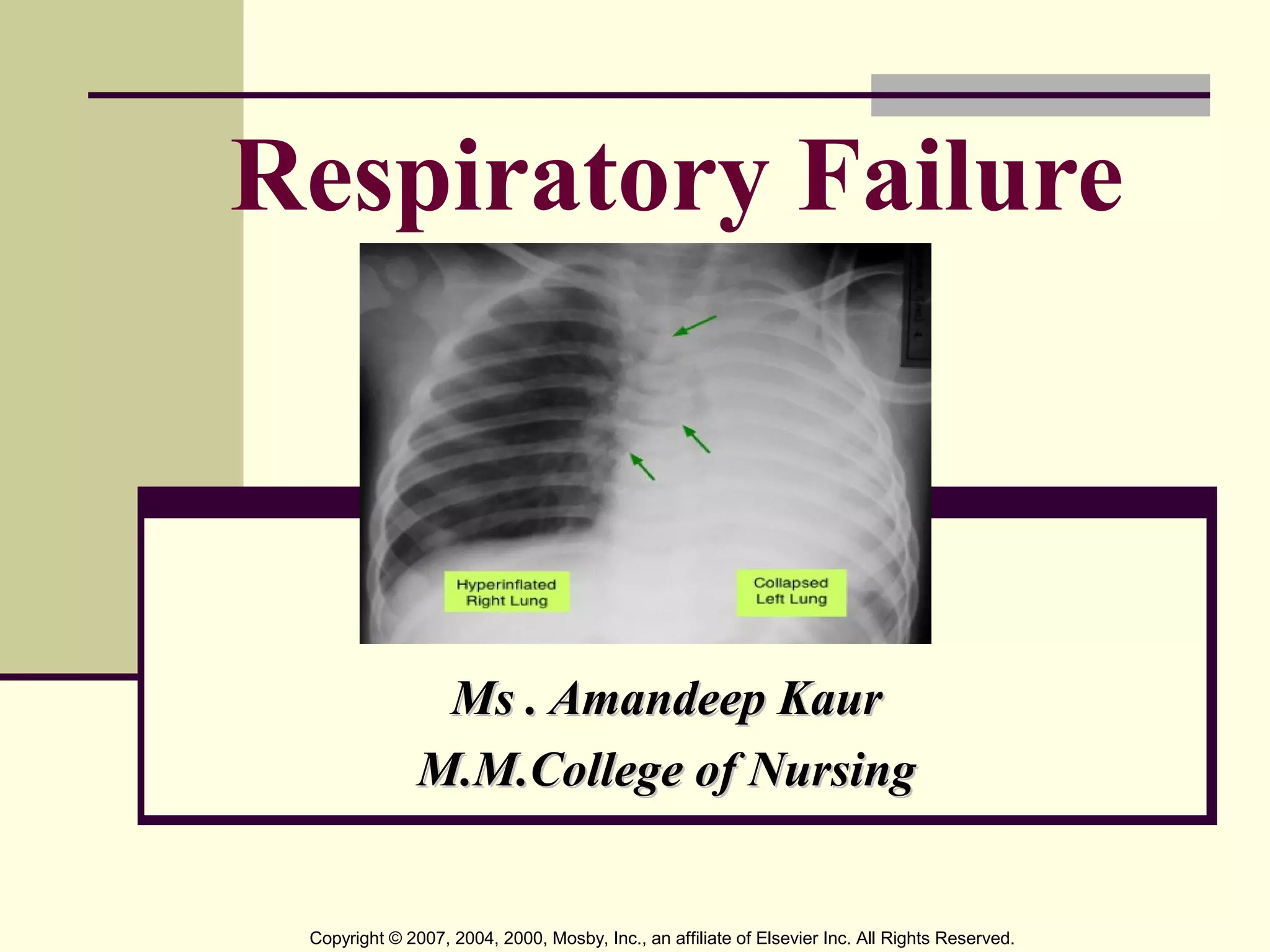 Respiratory failure | PPT