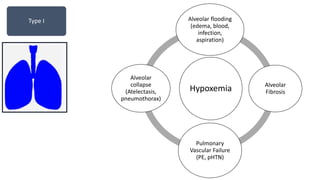 Respiratory failure | PPTX
