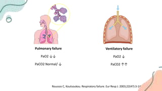 Respiratory Failure - Assesment, Type, and Management | PPT