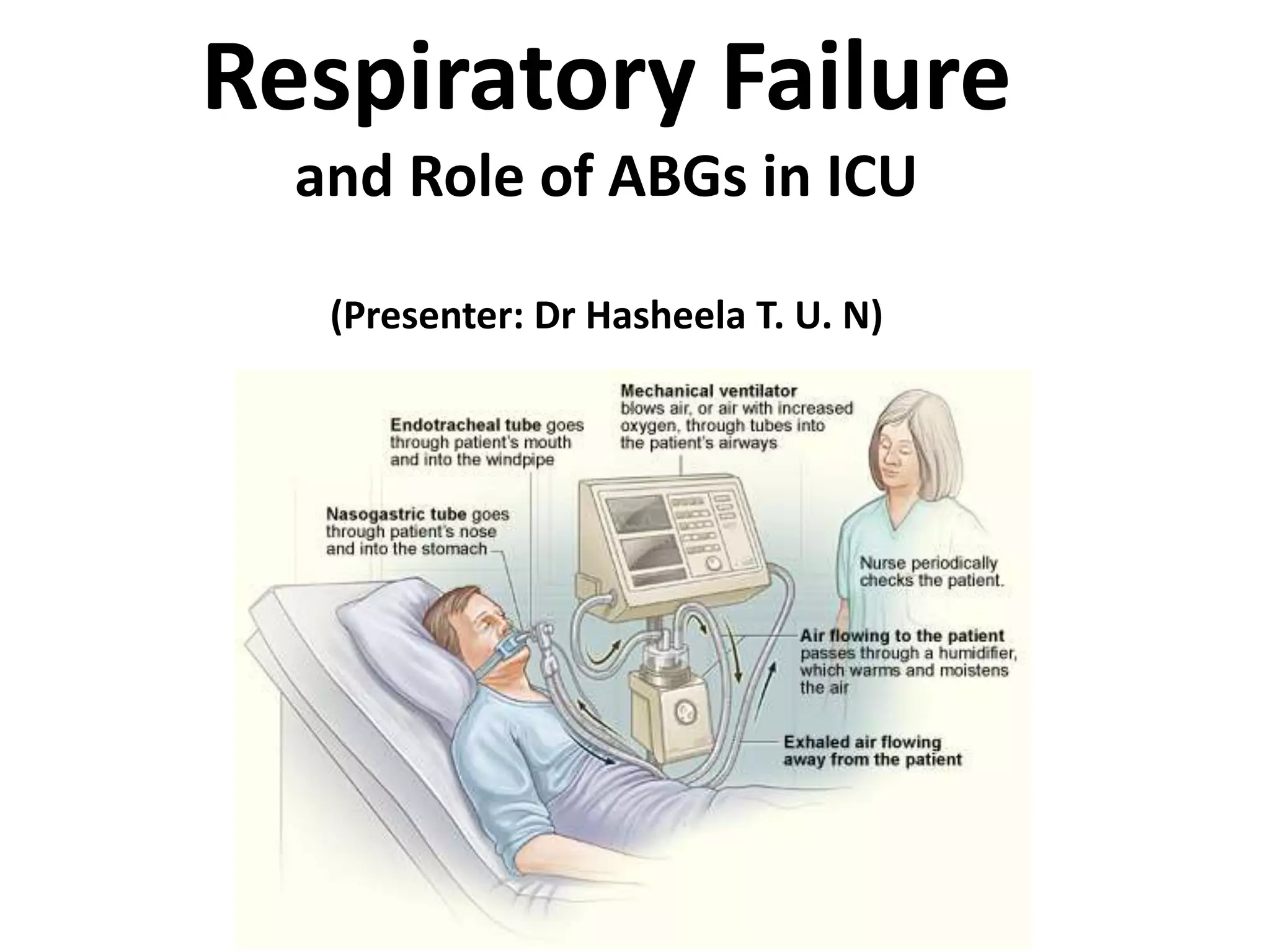 Respiratory failure role of abg's in icu | PPTX