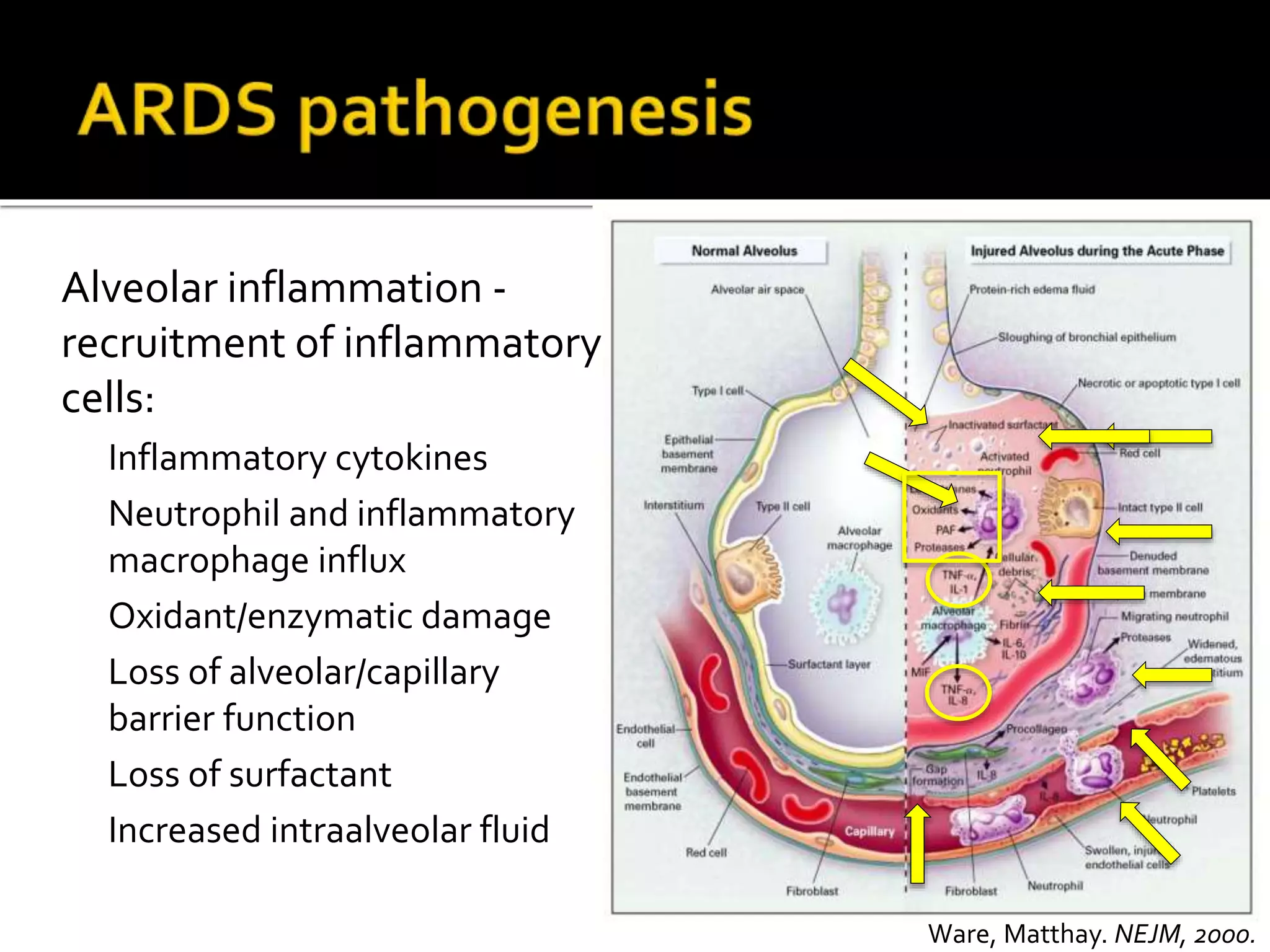Respiratory failure and the acute respiratory distress syndrome (and ...