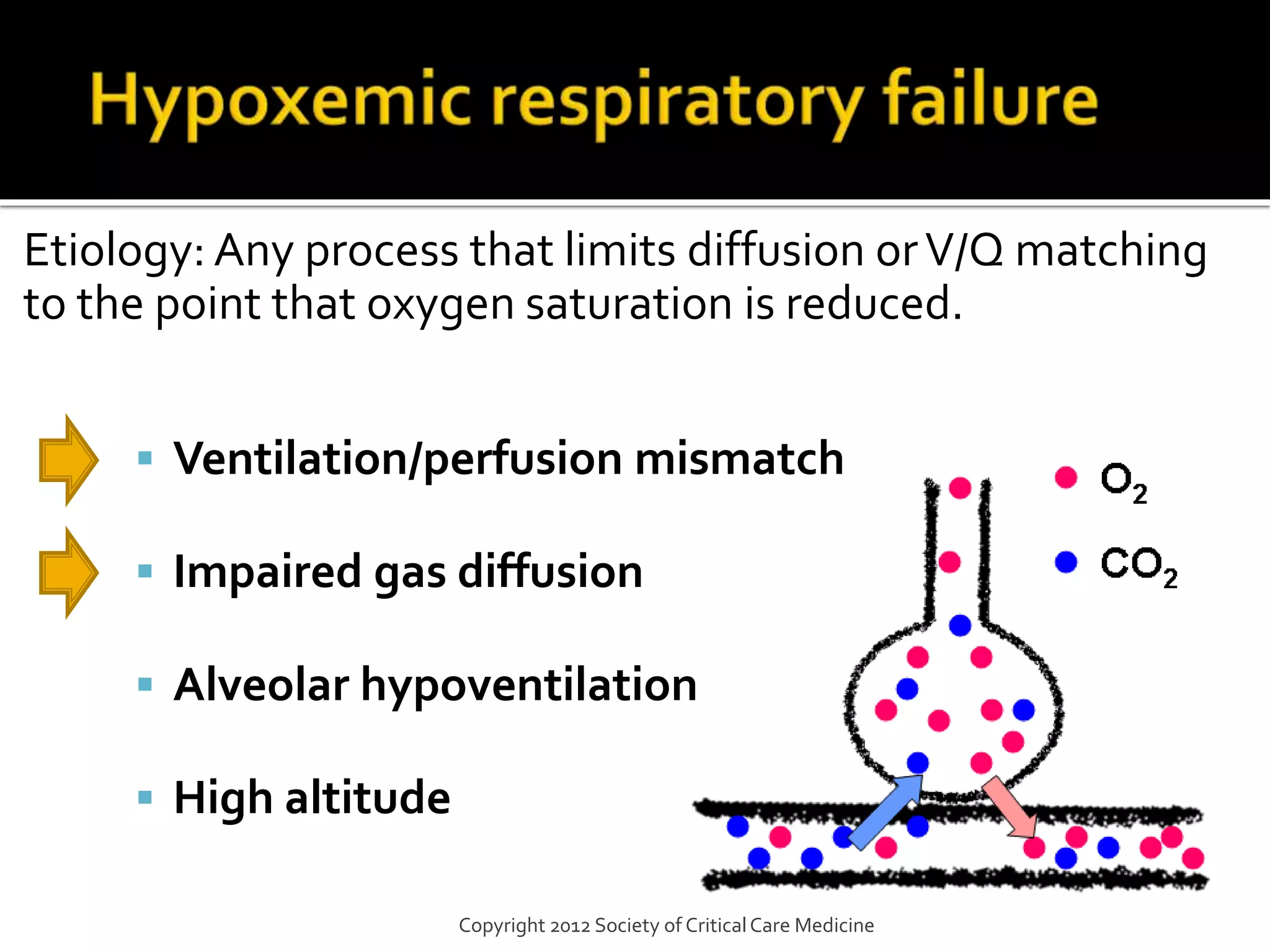 Respiratory failure and the acute respiratory distress syndrome (and ...