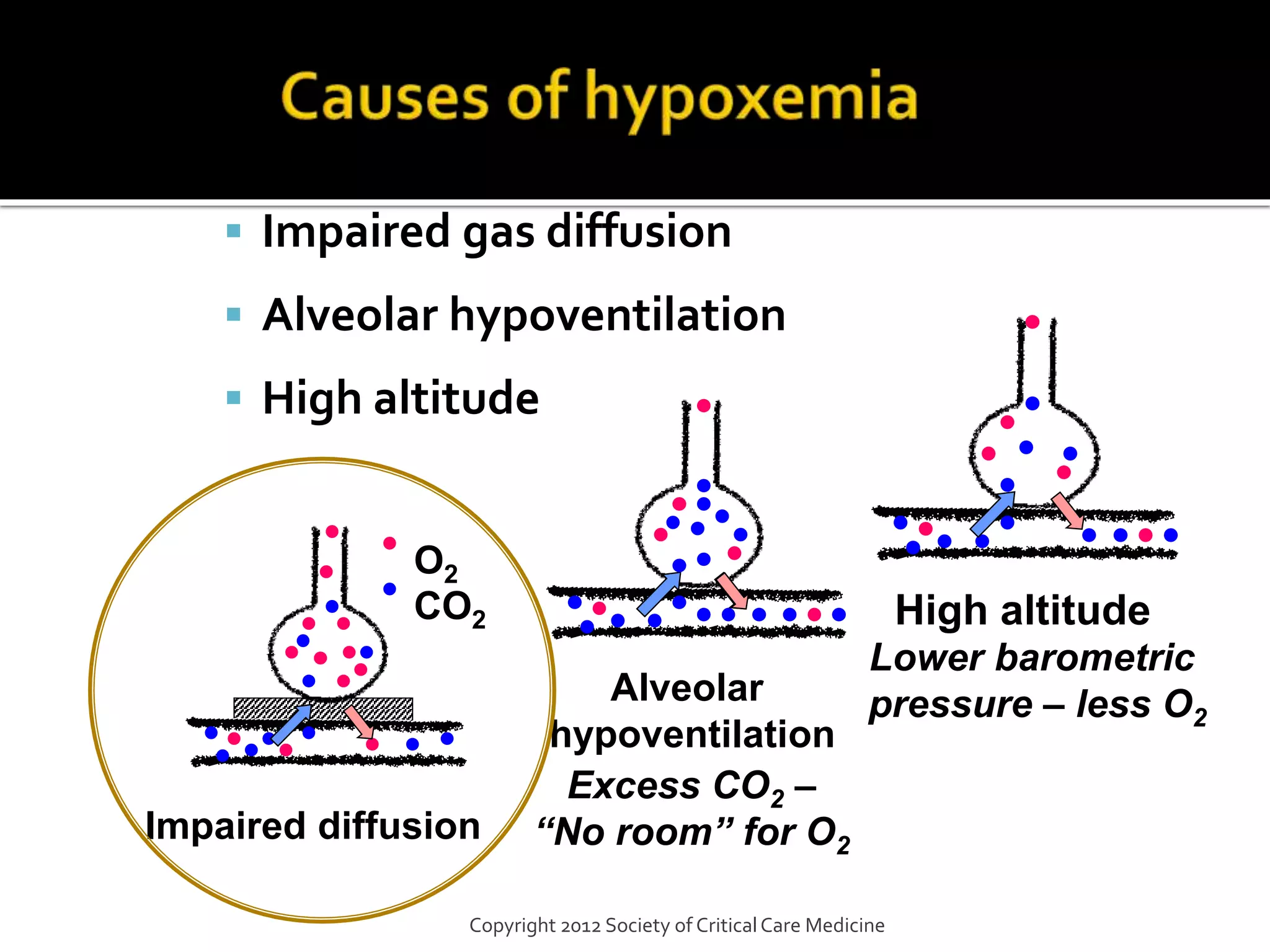 Respiratory failure and the acute respiratory distress syndrome (and ...