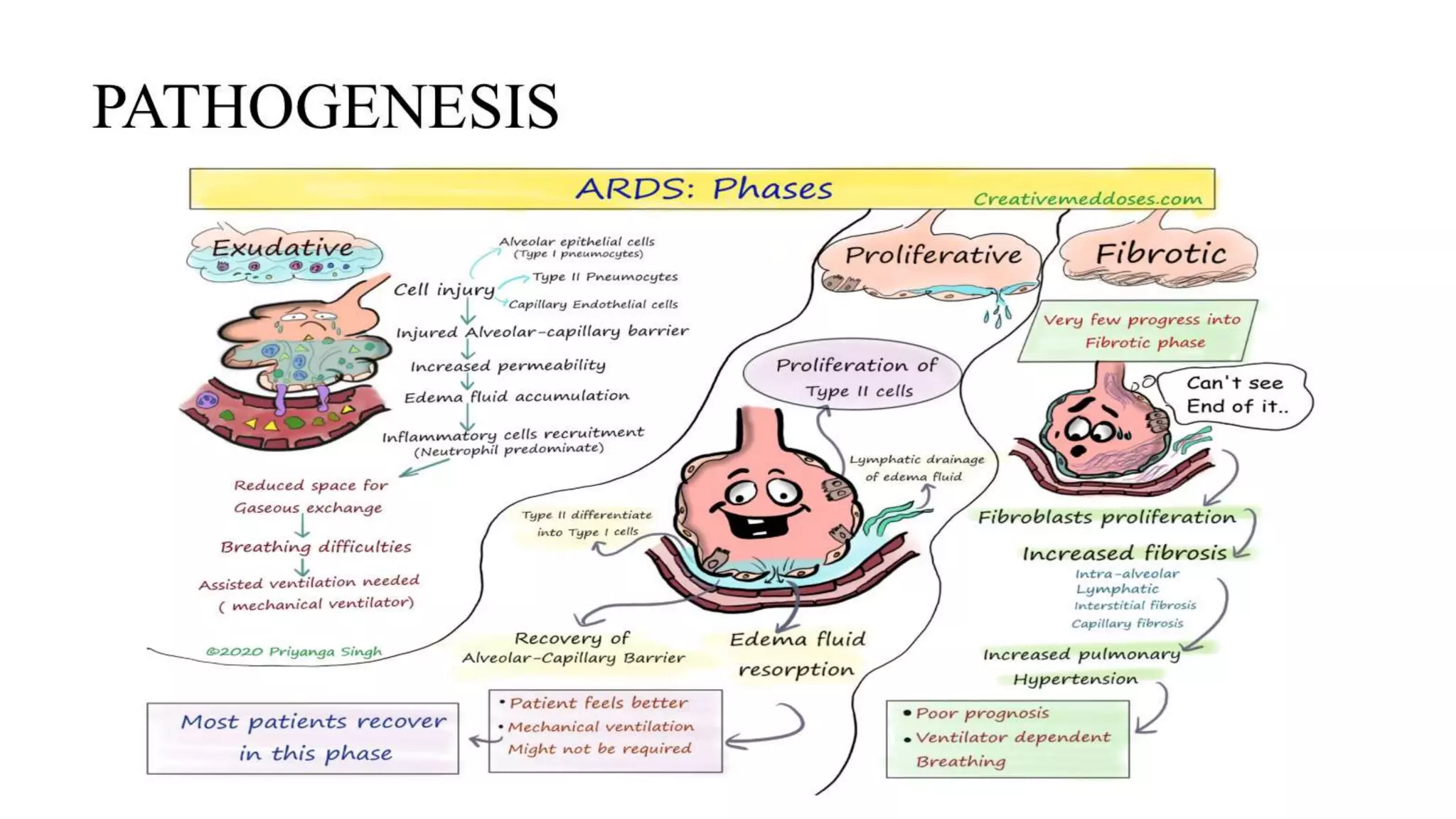 Respiratory Failure ARDS.pptx