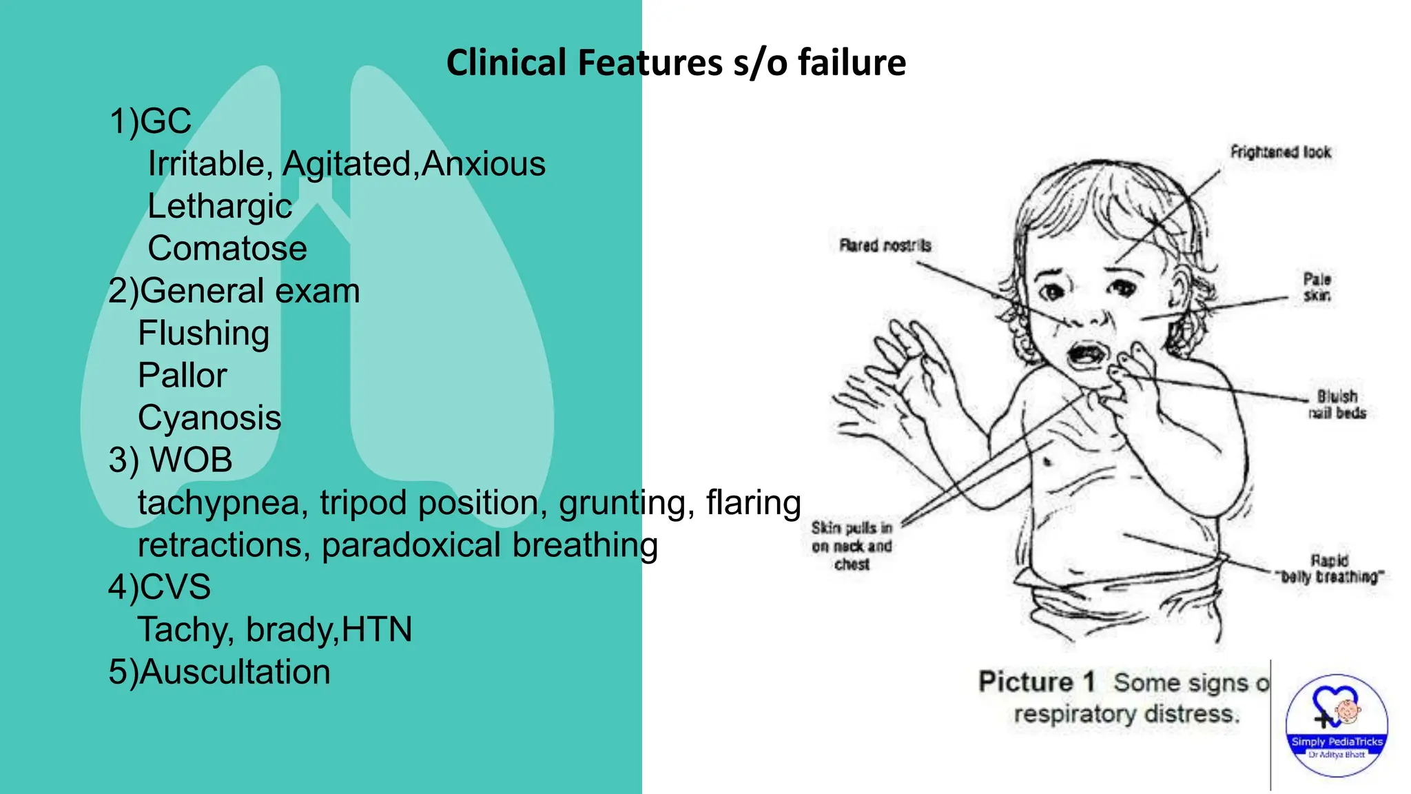 Respiratory Failure in Children-New .pptx