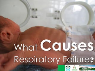 Respiratory failure ped | PDF