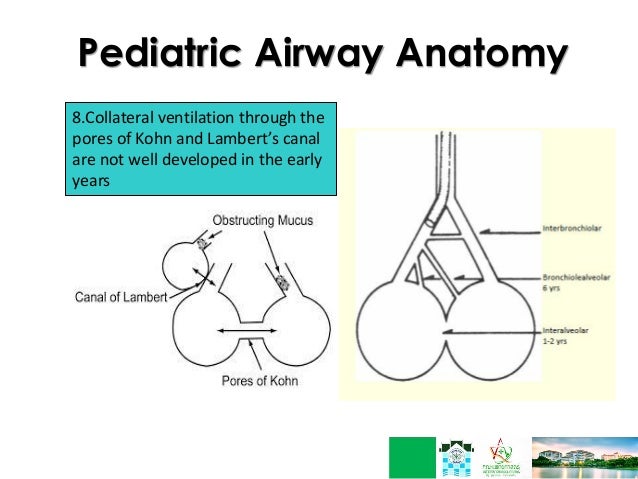 Respiratory failure ped