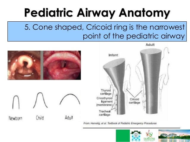 Respiratory failure ped
