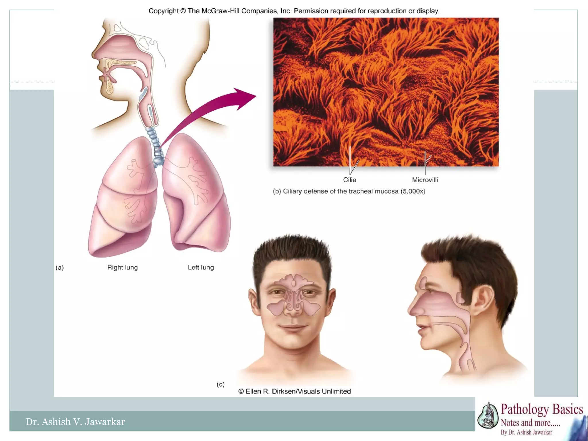 respiratory infections - microbiology | PPT