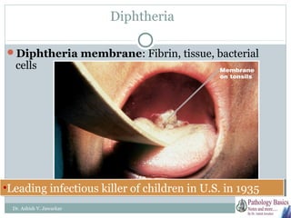 respiratory infections - microbiology | PPT