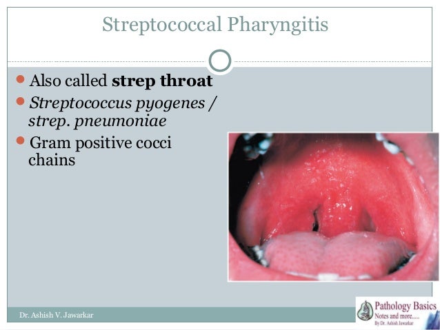 respiratory infections - microbiology
