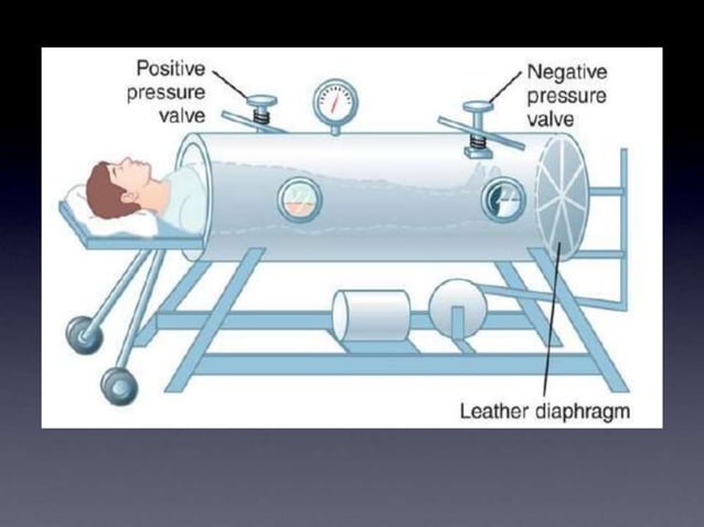 Respiratory insufficiency pathophysiology, diagnosis, oxygen therapy | PPT