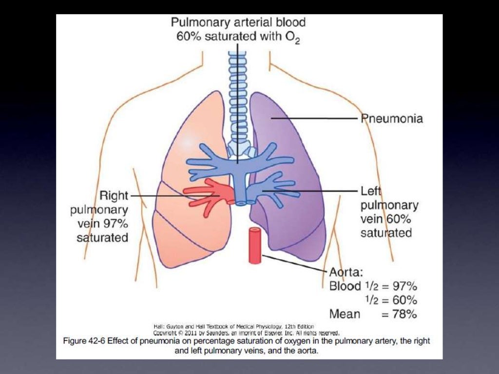 Respiratory insufficiency pathophysiology, diagnosis, oxygen therapy