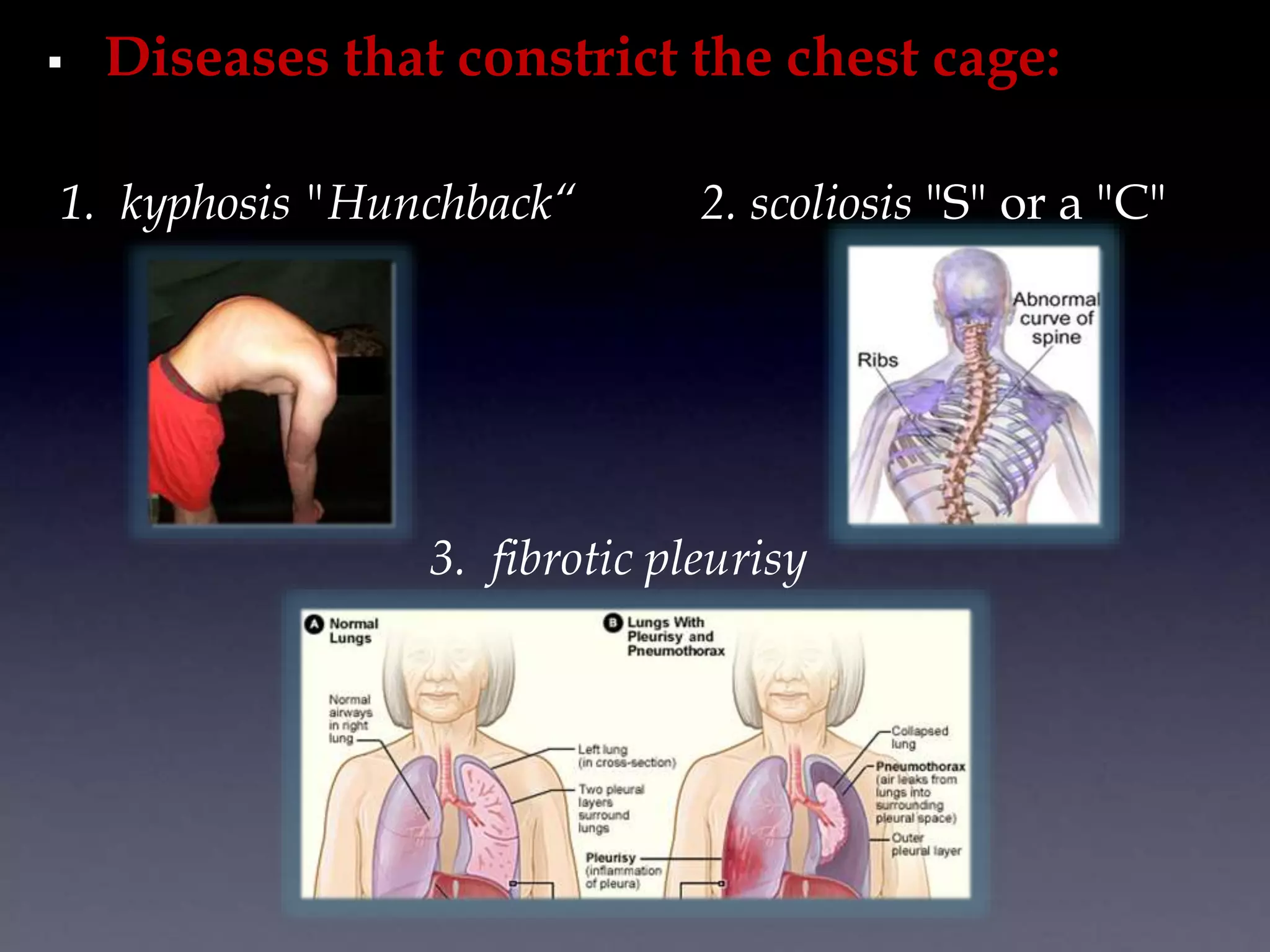 Respiratory insufficiency pathophysiology, diagnosis, oxygen therapy | PPT