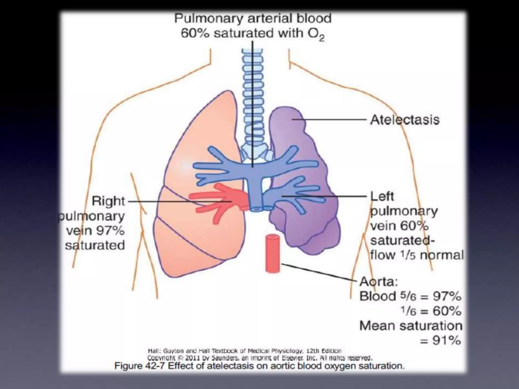 Respiratory insufficiency pathophysiology, diagnosis, oxygen therapy | PPT