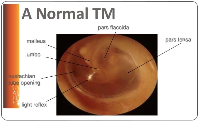 Respiratory lecture nurs 3340 fall 2017