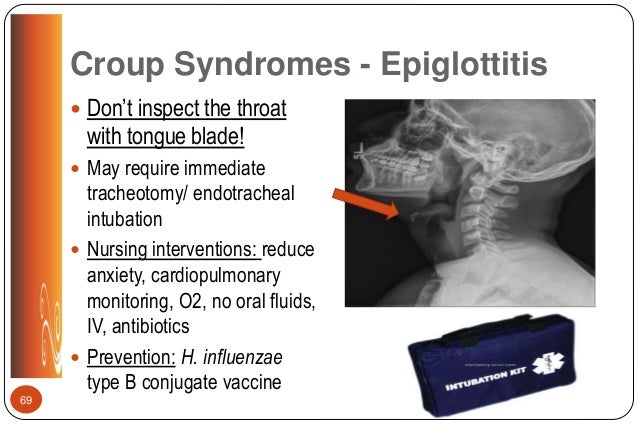 Respiratory lecture nurs 3340 spring 2017