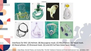 Respiratory Management in Acute Cardiac Care.pdf