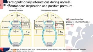 Respiratory Management in Acute Cardiac Care.pdf
