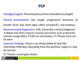 Respiratory Manifestations of HIV.ppt