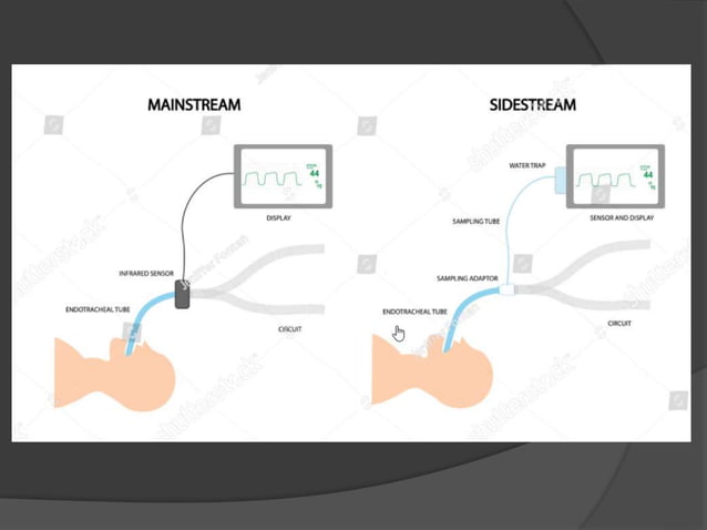 Respiratory Monitoring.pptx