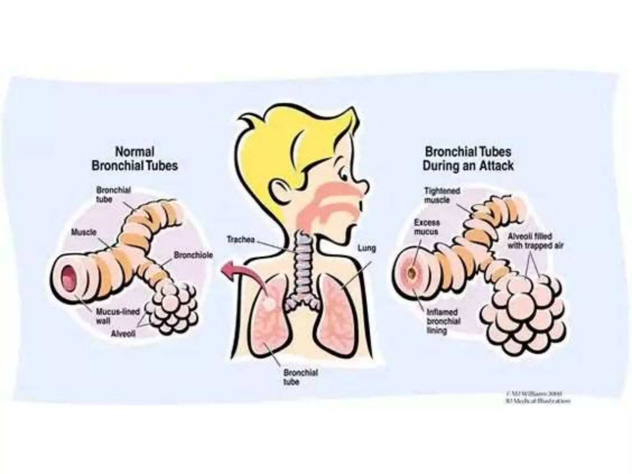 Respiratory newborn | PPTX