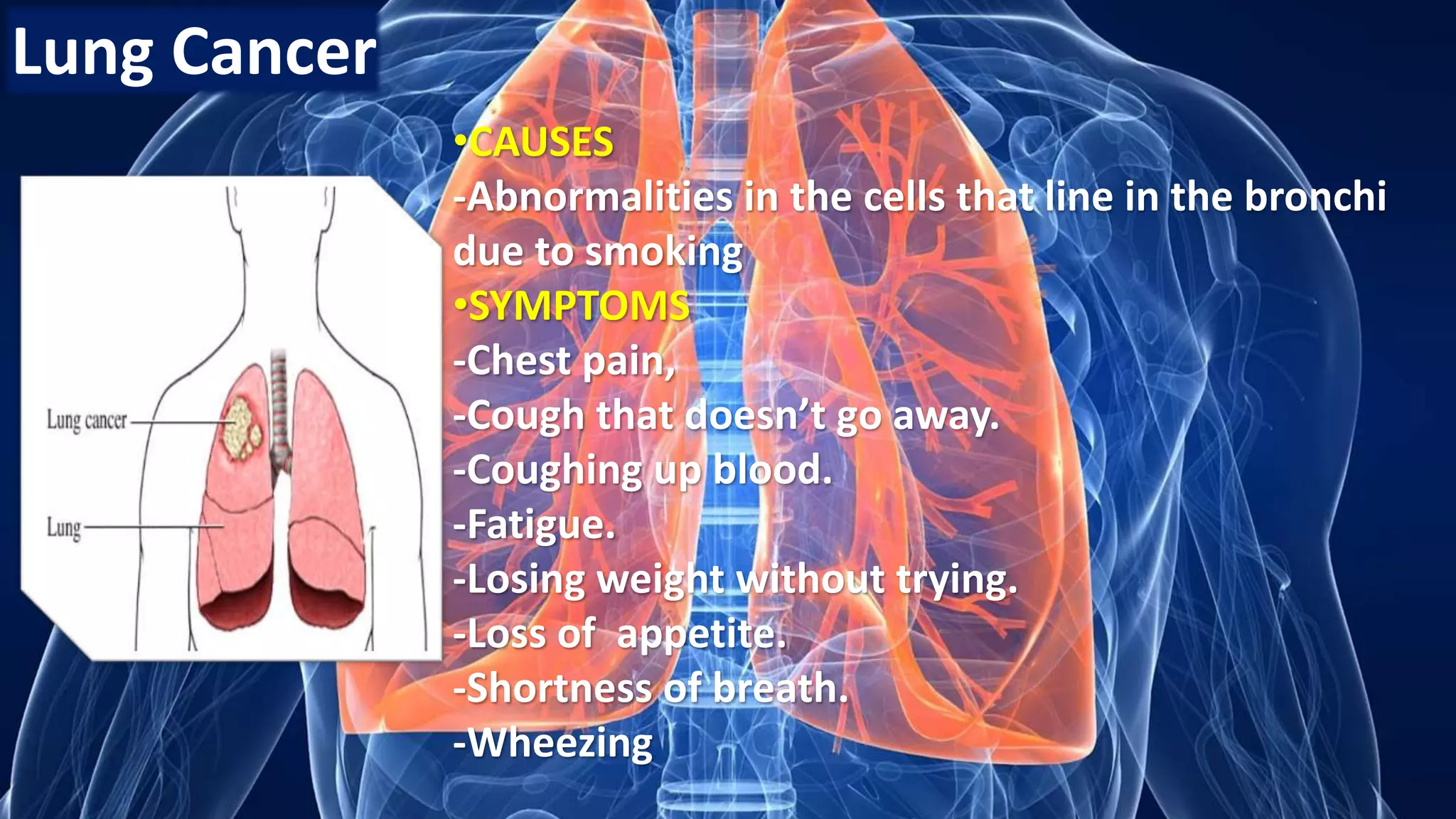 The Respiration and the Problems of Respiratory System | PPTX