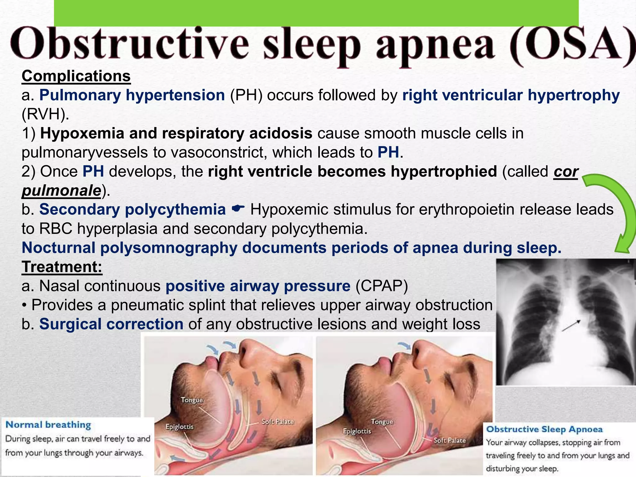 Respiratory pathology | PPTX