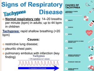 Respiratory pathology | PPTX