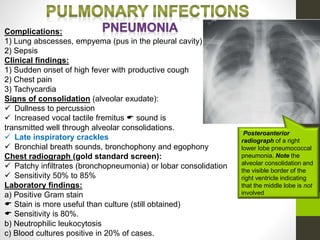 Respiratory pathology | PPTX