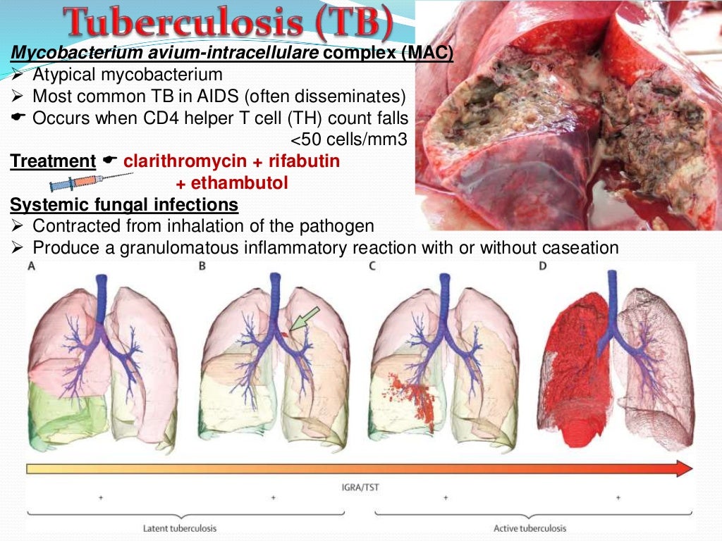 Respiratory pathology