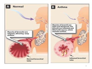 Respiratory pharmacology.pptx | Lung and Respiratory Health | Diseases and Conditions