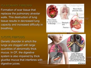 Respiratory system | PPT