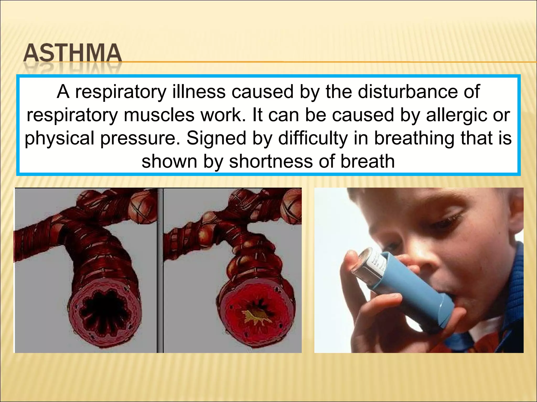 Grade 8 - Respiratory System | PPT