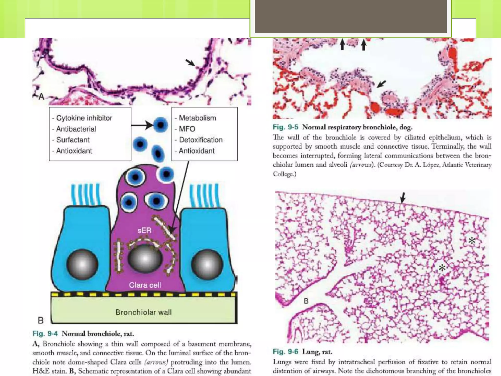 Physiological, anatomical barriers of the respiratory system | PPTX