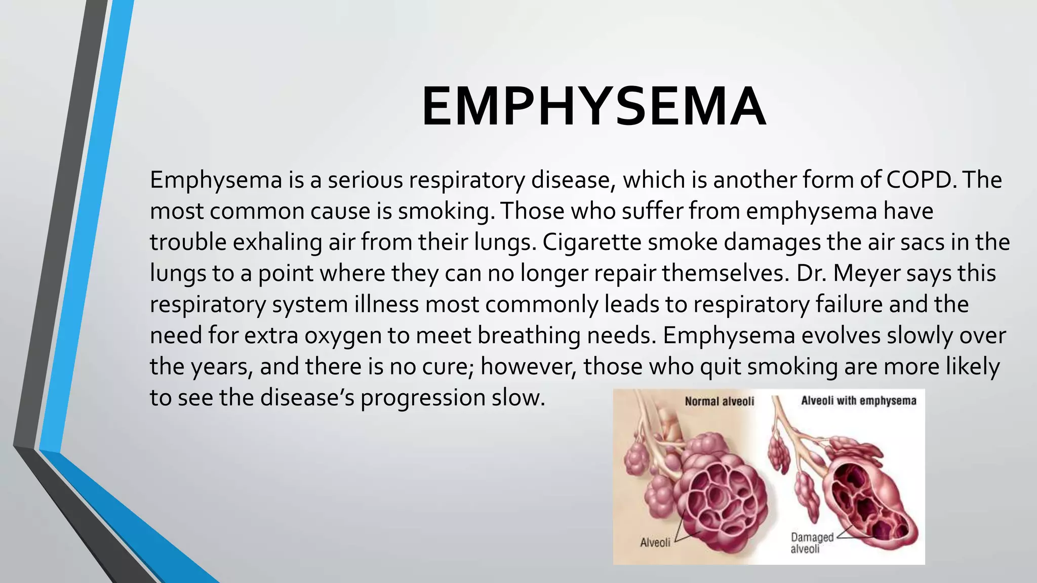 The Respiratory System for Science 9 | PPTX