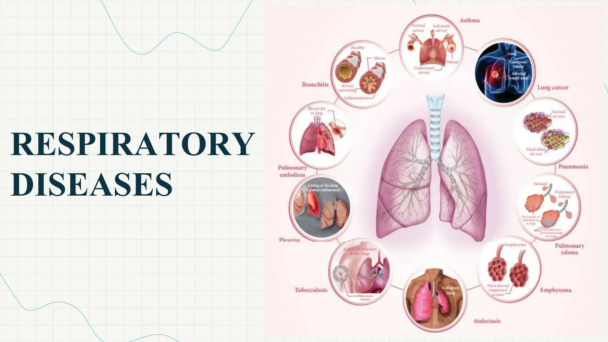 RESPIRATORY SYSTEM- HUMAN ANATOMY AND PHYSIOLOGY | PPTX | Lung and Respiratory Health | Diseases ...