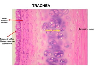 Trachea | PPT