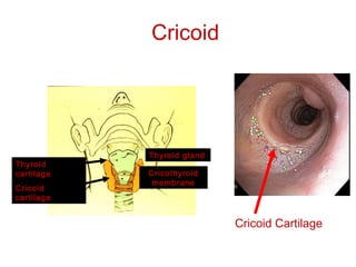 Trachea | PPT