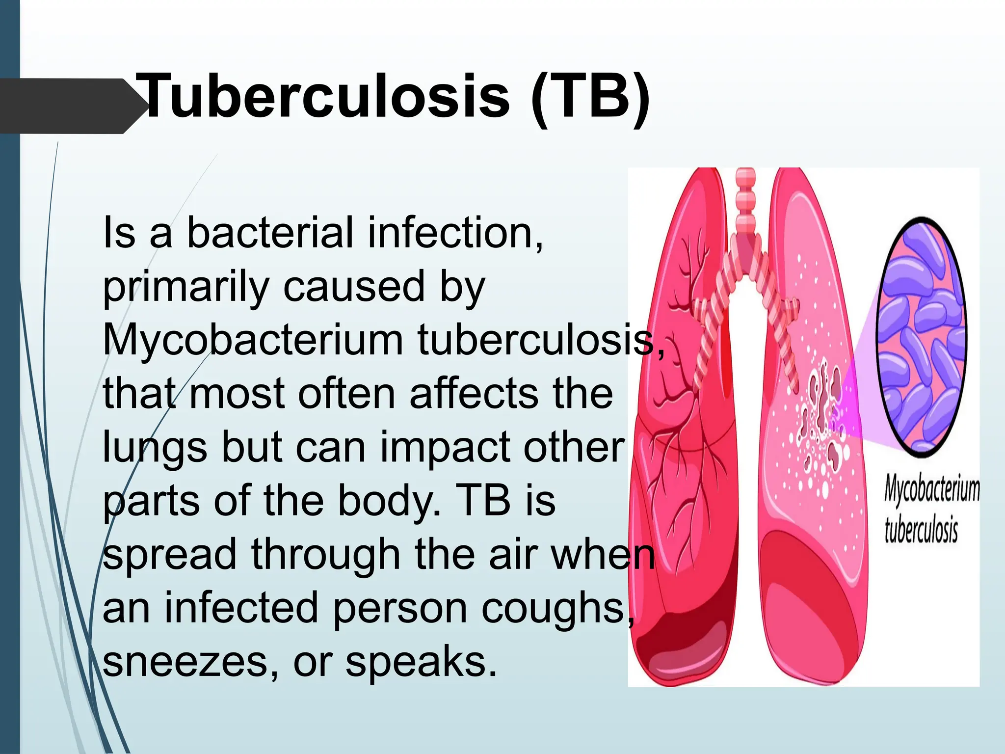 Respiratory_System diseases.pptxxxxxxxxxxxxxx | PPTX