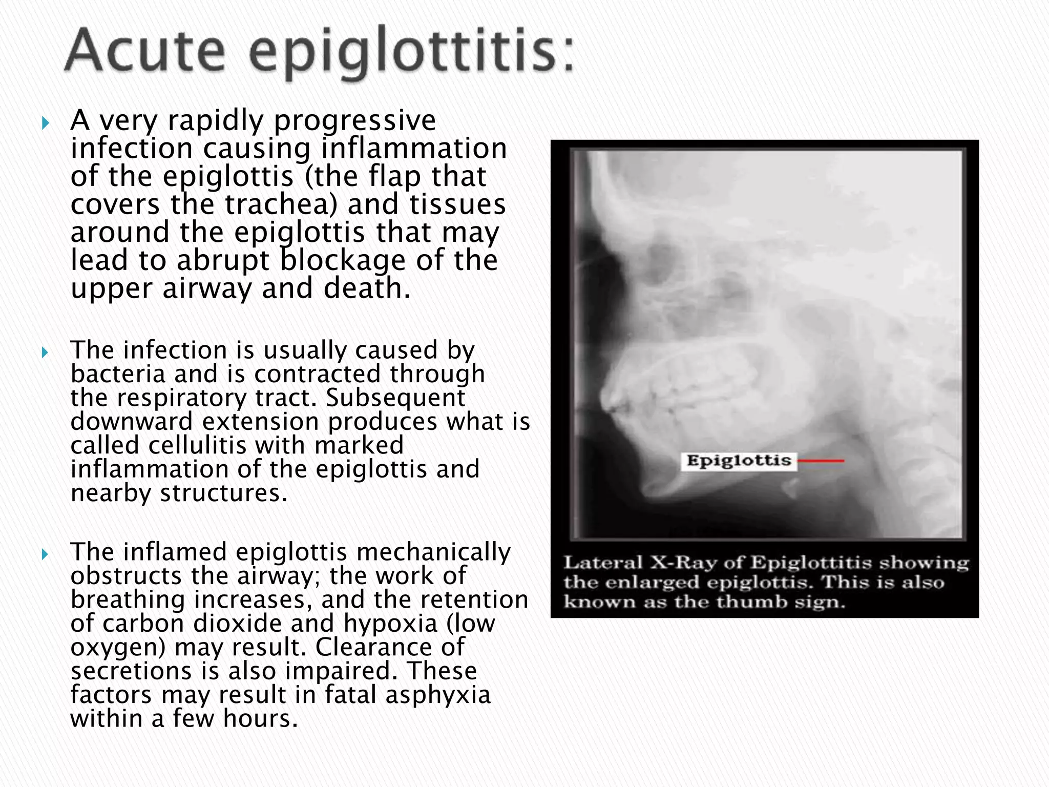 Respiratory system diseases | PPTX