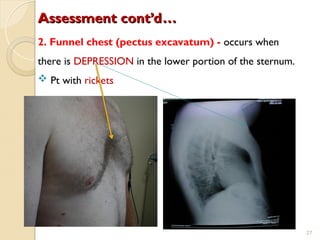 Upper and lower Respiratory system disorder.ppt