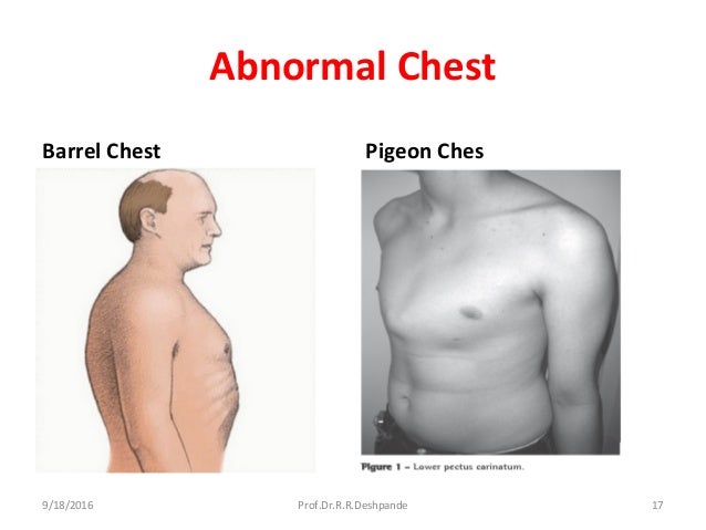 Respiratory system examination