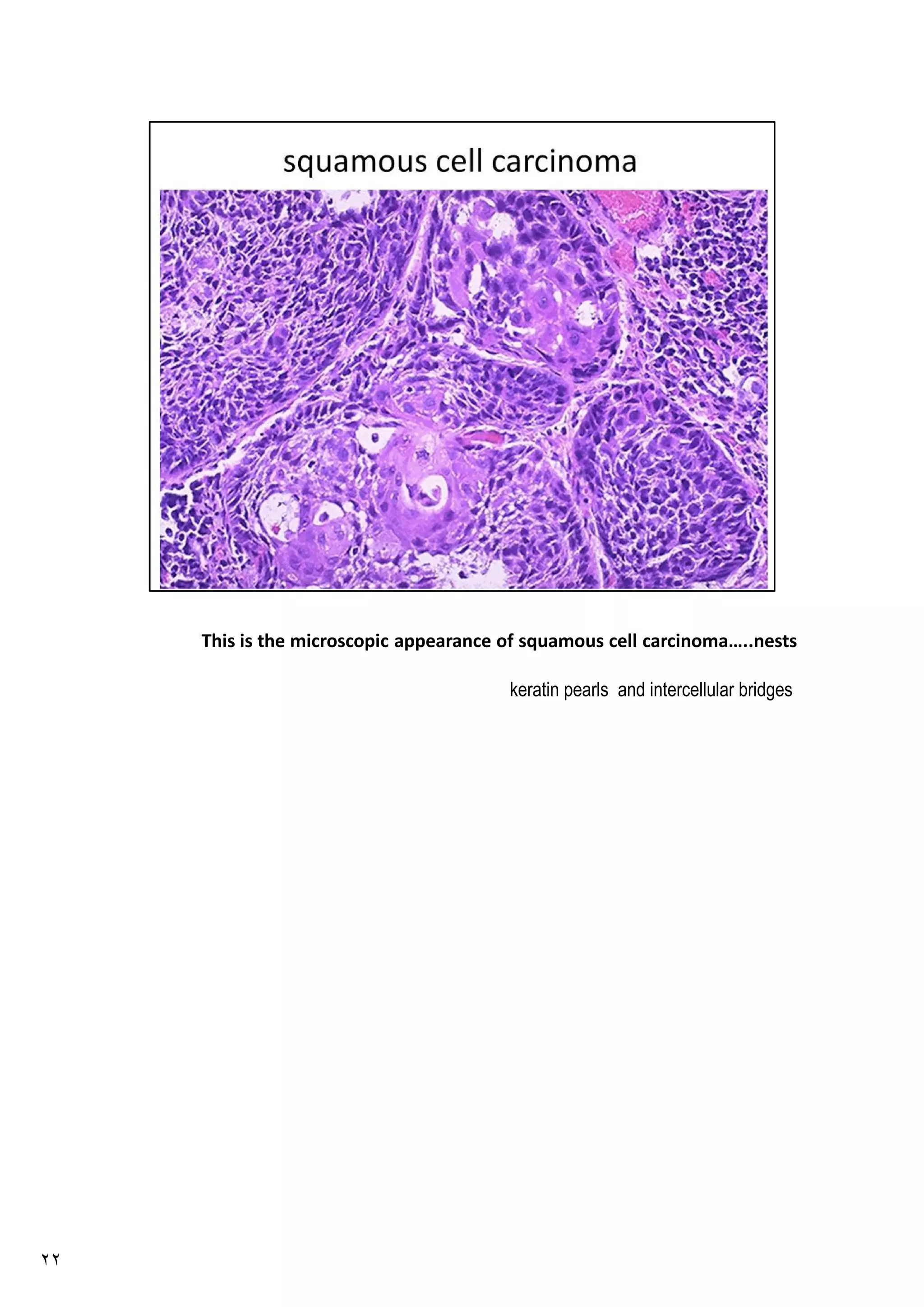 Respiratory system pathology lab | PDF