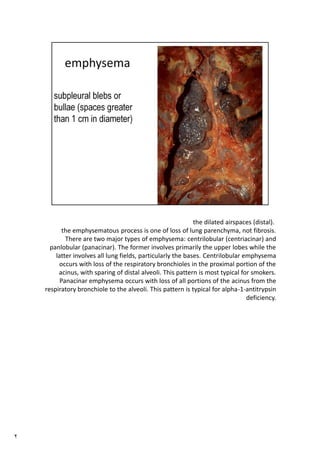 Respiratory system pathology lab | PDF | Lung and Respiratory Health ...