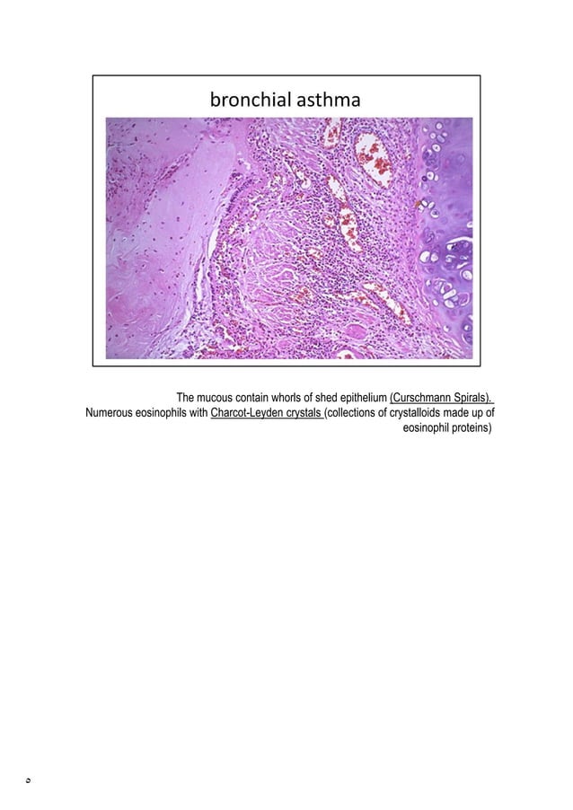 Respiratory system pathology lab | PDF | Lung and Respiratory Health ...